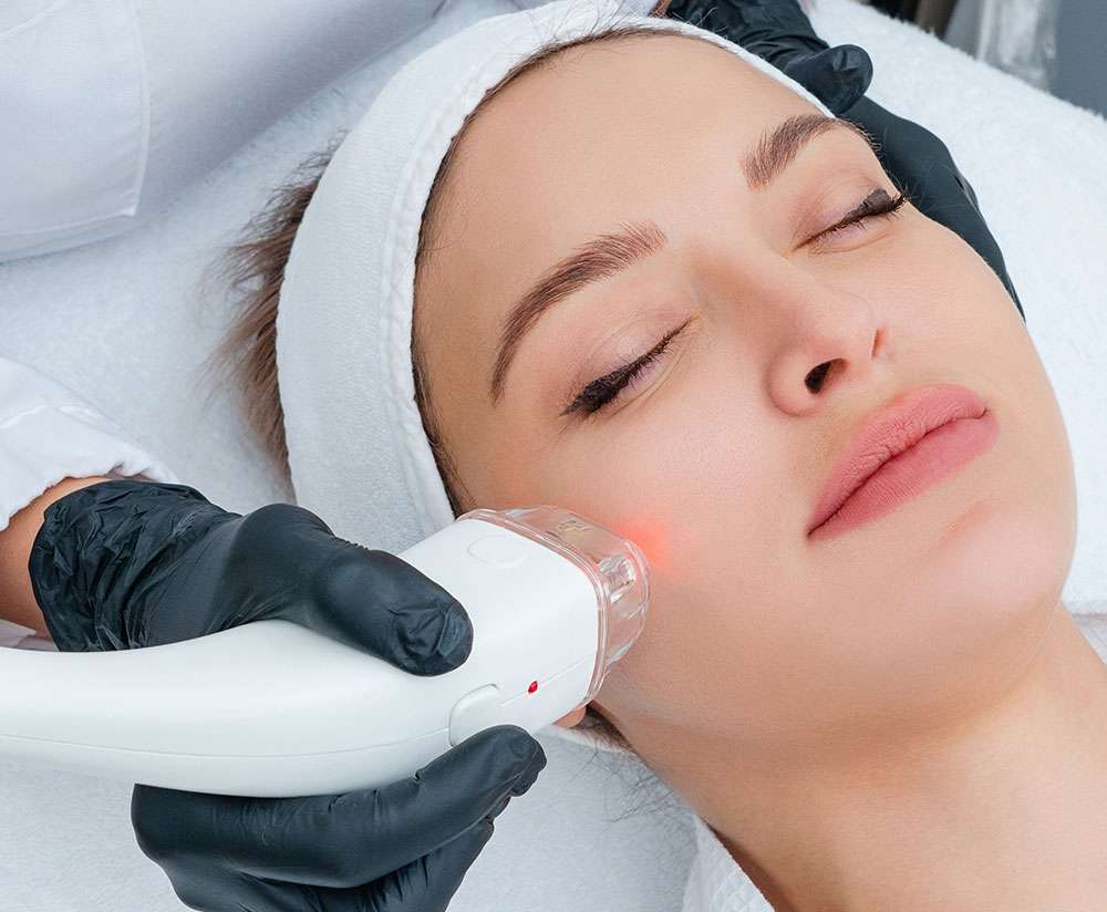 IPL Treatment - Venetian Medical Spa and Aesthetic Surgery